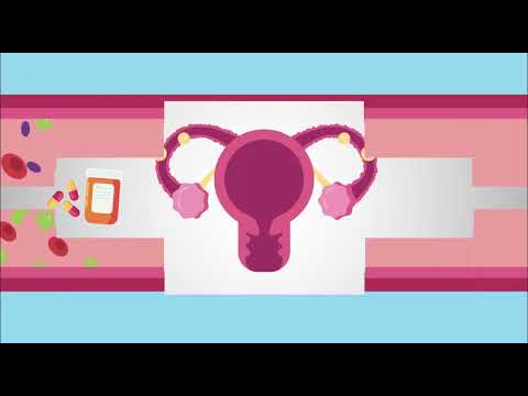 Things to Know About Pelvic Inflammatory Disease ! - Grasp Medicine
