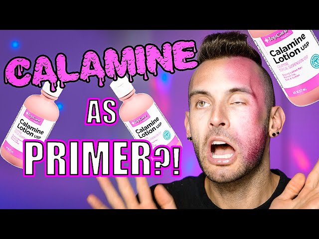What does calamine lotion do? TikTok warns against viral trend