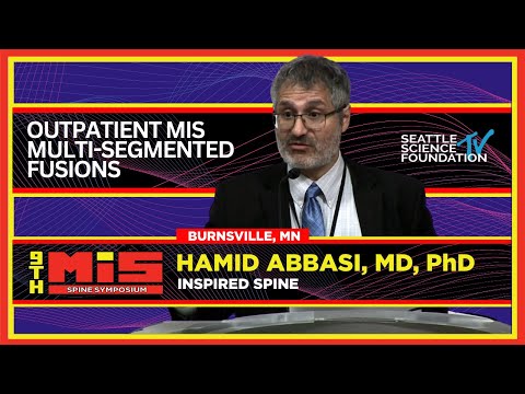 Outpatient MIS Multi-Segmented Fusions - Hamid Abbasi, M.D.