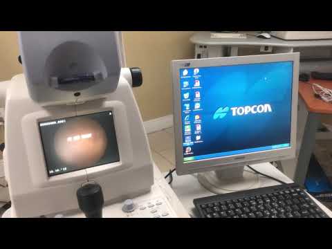 Fundus Camera - Retinal Camera Latest Price, Manufacturers & Suppliers