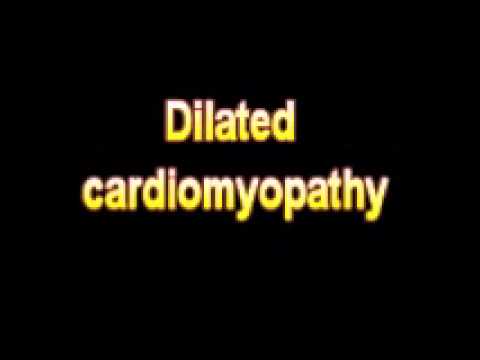 What Is The Definition Of Dilated cardiomyopathy - Medical Dictionary Free Online