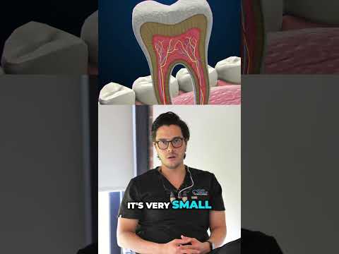 How to Reverse Tooth Decay 🦷