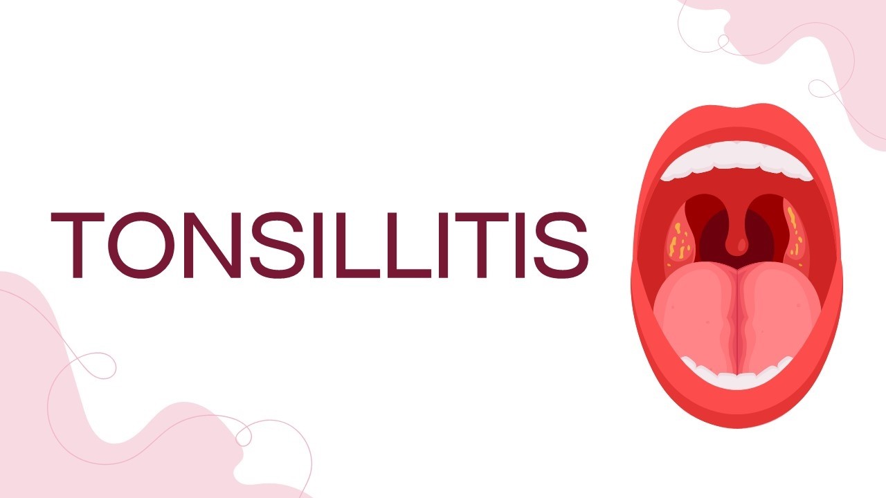 Tonsillitis Animated PPT Slides