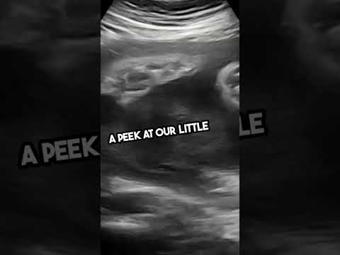 WHAT IS ANC (ANTENATAL CARE)