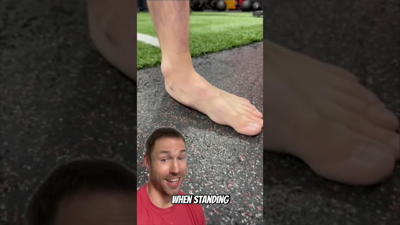 The TRUTH About ‘Flat Feet’🤯