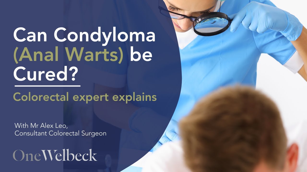 Expert Surgeon Explains Condyloma (Anal Warts) | Prevention & Treatment | OneWelbeck
