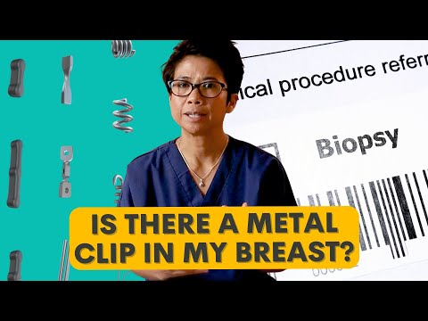 Metal Clips in the Breast: Purpose, Procedure, and What to Expect - with Dr Tasha