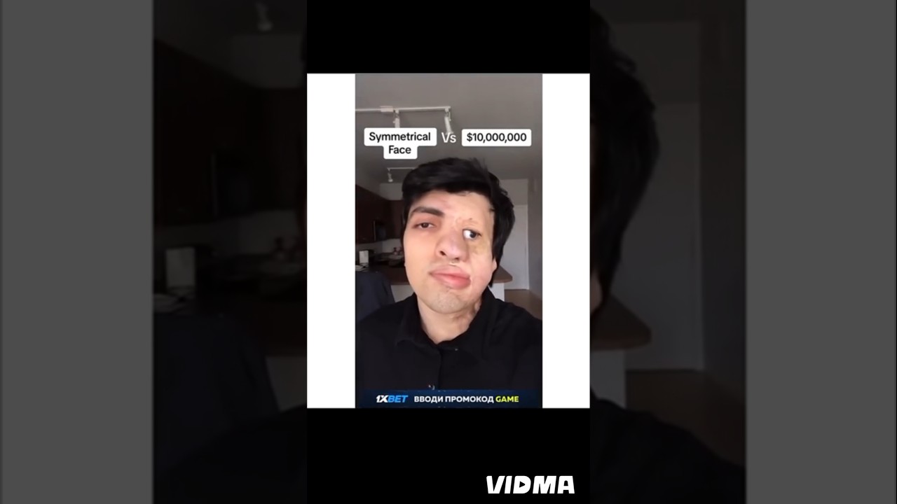 Symmetrical face 🤣🤣🤣 #funny #laugh