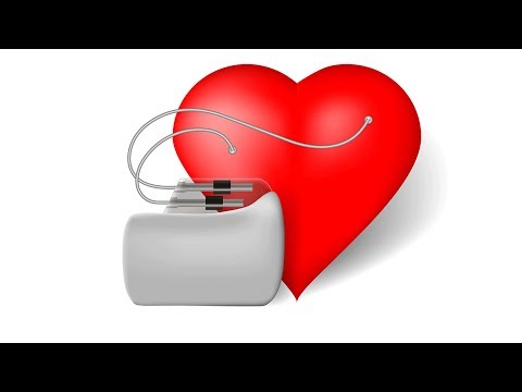 When should one get Pacemaker? - Dr. A Naga Srinivaas