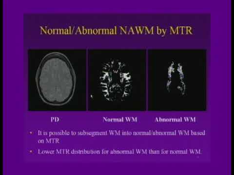 White Matter Disease CT and MRI