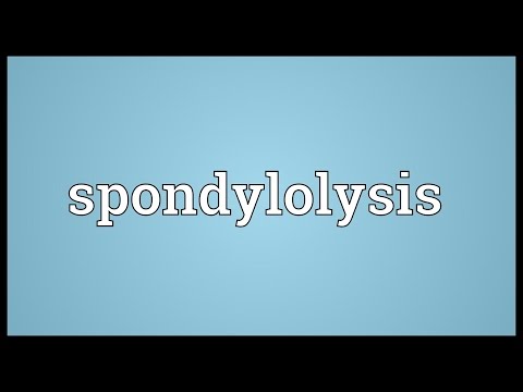 Spondylolysis Meaning