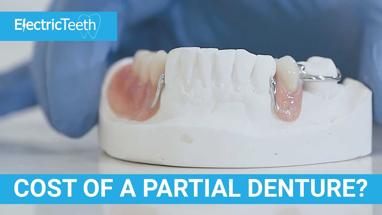 How much are partial dentures? - Dentist in Woodbridge
