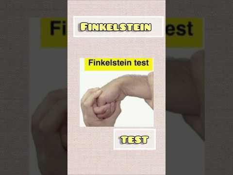 "Finkelstein Test: A simple yet effective way to diagnose De Quervain's Tenosynovitis
