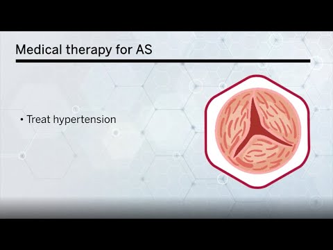 Indications for Aortic Valve Replacement in Aortic Stenosis