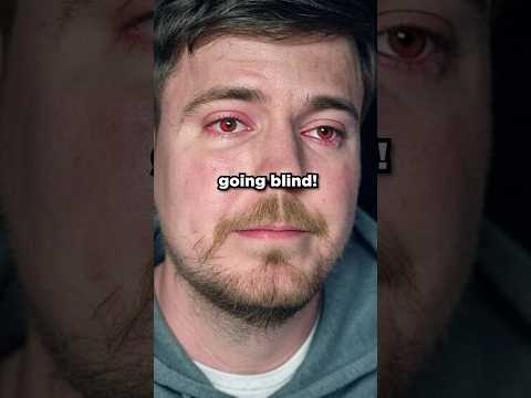 We Saved MrBeast From Going BLIND ????