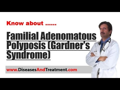 Familial Adenomatous Polyposis (Gardner's Syndrome) : Causes, Diagnosis, Symptoms, Treatment