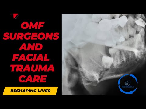 Saving Lives And Changing Faces: Omf Surgeons And Facial Trauma Care #facial #omfs #oralhealth