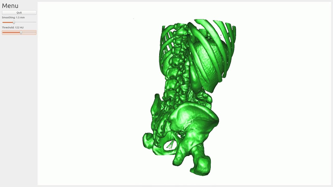 GPU-based marching cubes surface extraction in FAST