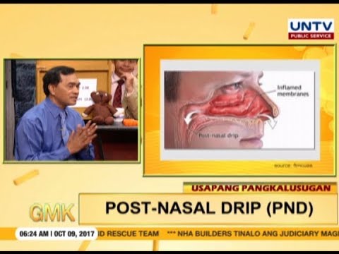 All about Post-nasal drip (PND) | Usapang Pangkalusugan