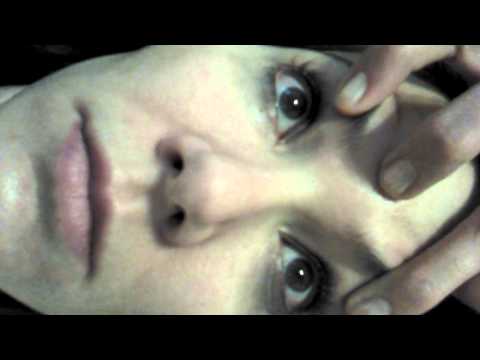 left lower eyelid 3