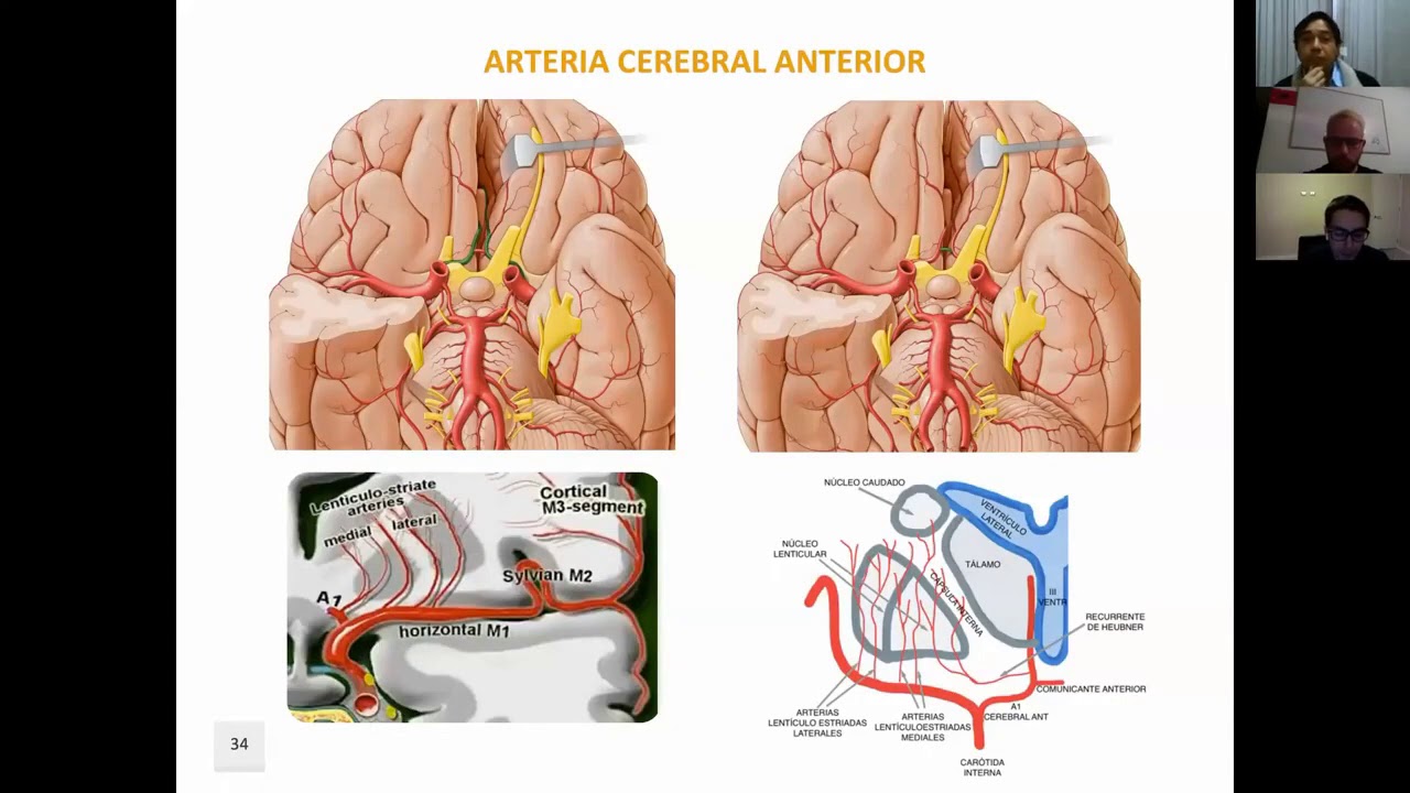 Stroke (CVA) Part 3: Basic Neuroanatomy for Neuroimaging
