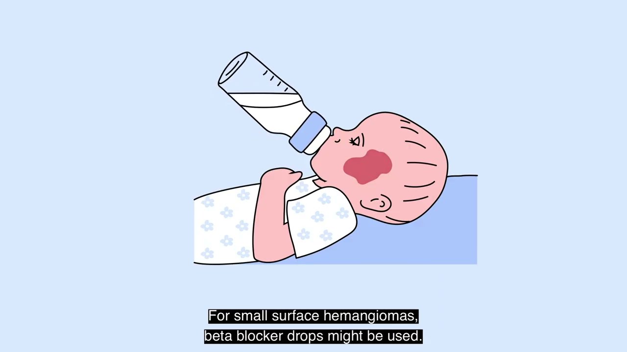 Animation: Infantile Hemangiomas (Strawberry Birthmarks)