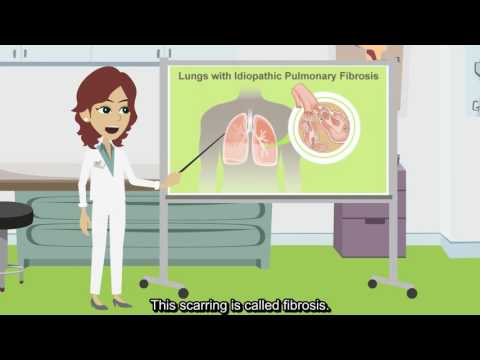 What is IPF?