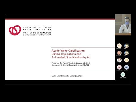 Aortic Valve Calcification: Clinical Implications and Automated Quantification by AI