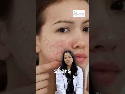 Always see a qualified dermatologist for your skin-related issues! #dermatologist #skincare