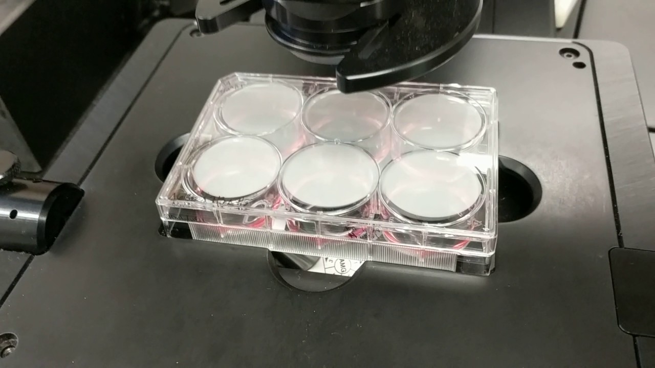 What do Mesenchymal Stem Cells Look Like In Culture?