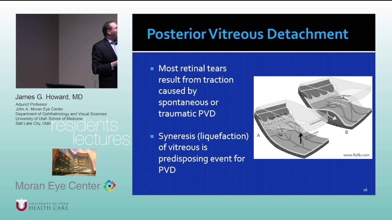 Retinal Detachment [ARCHIVE]