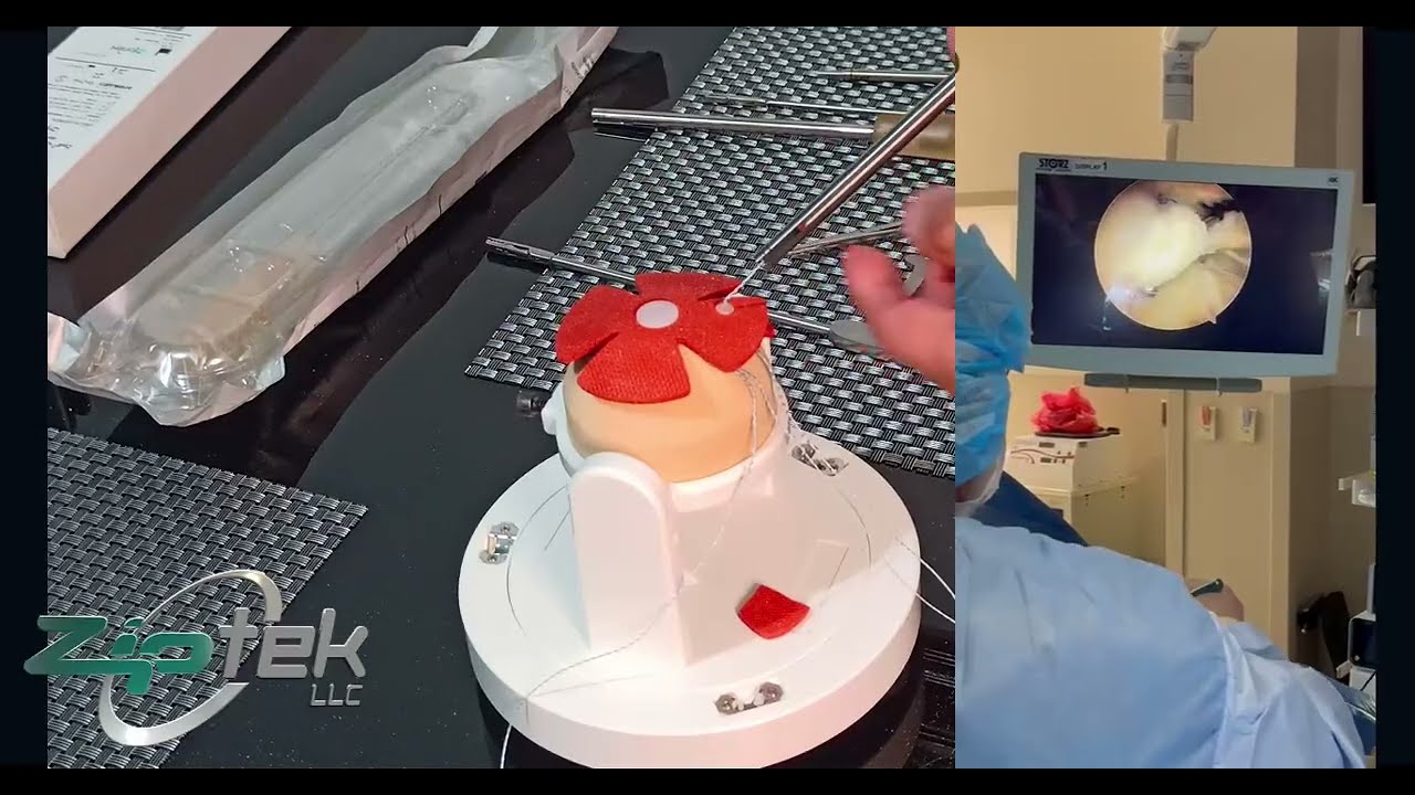 ZipE® BioLock Sawbones Training | 10.- Interpositional Graft