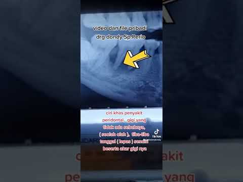 penyakit periodontal atau jaringan penyangga gigi