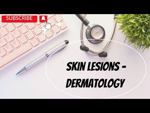 Dermatology - Skin lesions : Macules, Papules, Moles, Nevus etc