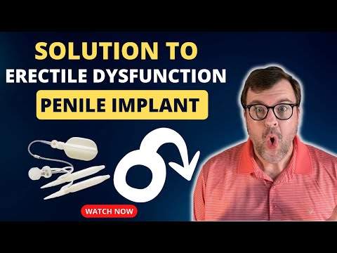 Learn about long lasting ED Solution- Dr Kent DeLay in Columbia and Lexington SC