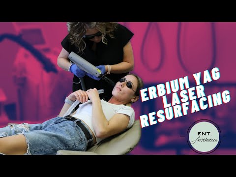 Erbium YAG Laser Resurfacing