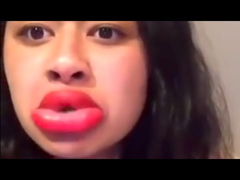 Yikes! This is What a Kylie Jenner Lip Challenge Fail Looks Like Check ...