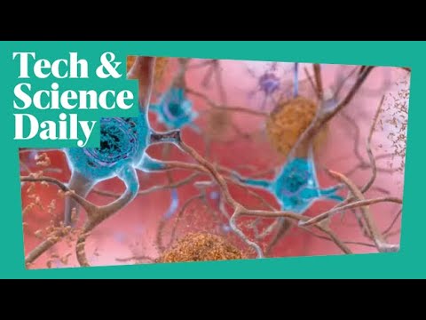 Alzheimer’s disease drug breakthrough ...Tech & Science Daily #podcast