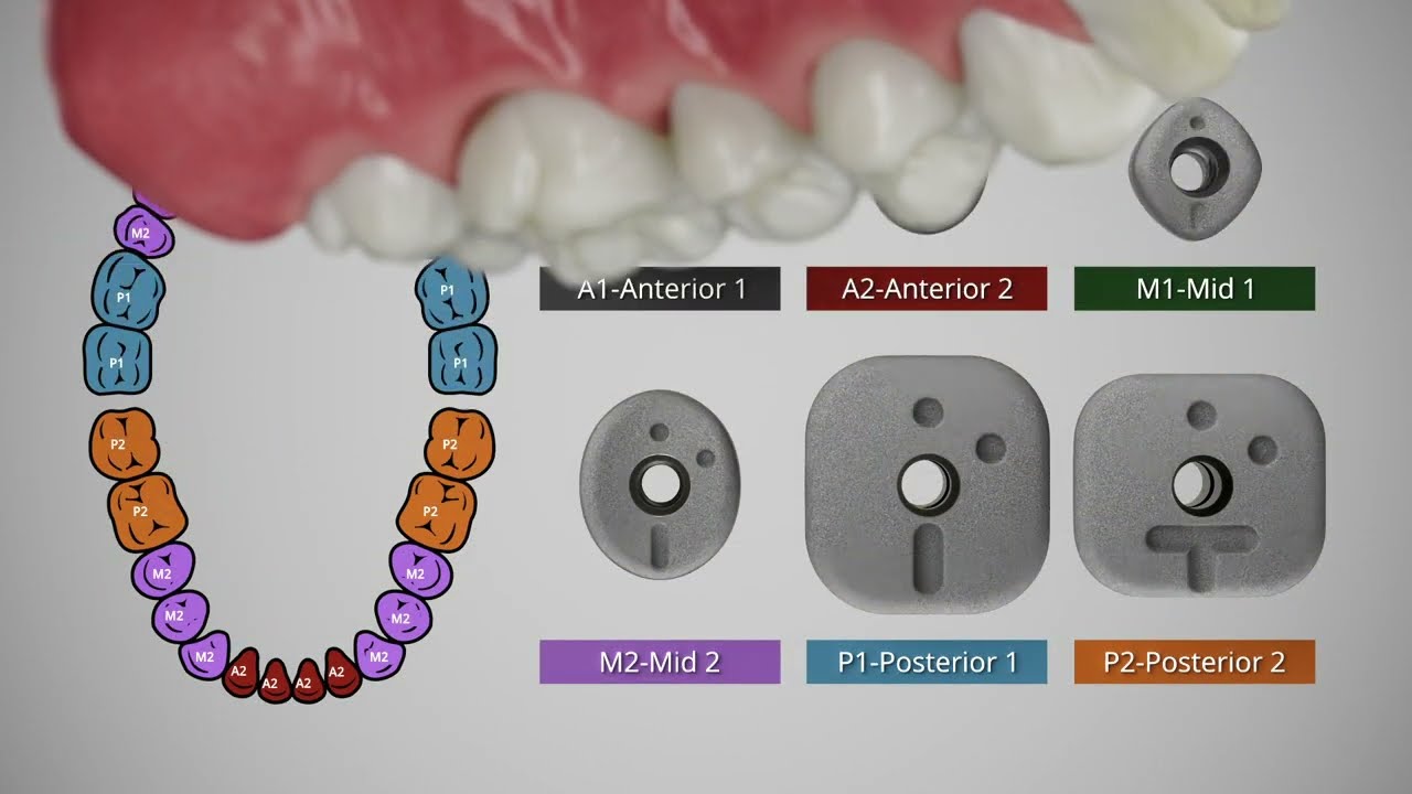 How To Use SmartShape™ Healers: A Guide to the Anatomically Designed Healing Abutments