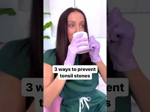 3 ways prevent tonsil stones #shorts