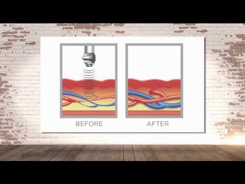 You can be intimate again with this treatment that has no side effects