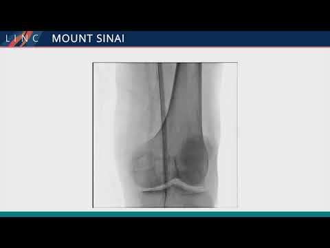 Case Presentation II – Amit Srivastava, MD