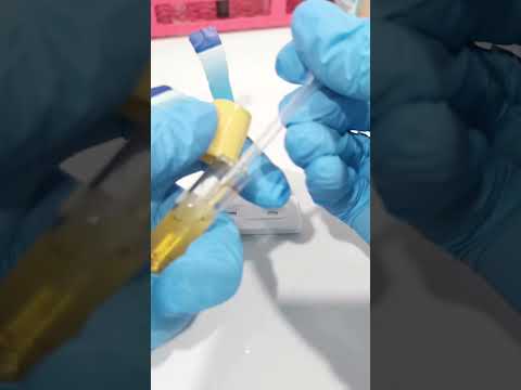 Non-reactive HBsAg Screening Test