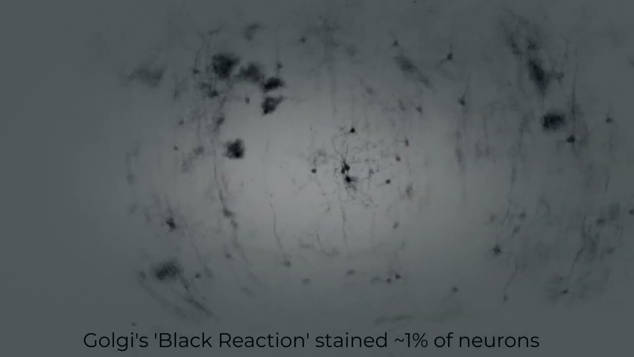BRAIN at 10 Video Finalist: Cortical Density