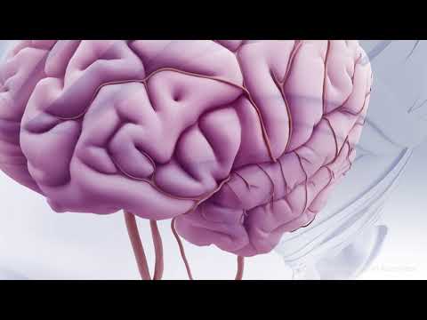 Ischemic Stroke With tPA Animation