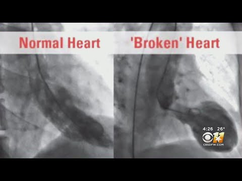 Ones For Wellness: Broken Heart Syndrome