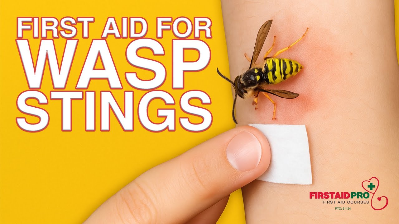 First Aid for Wasp Stings