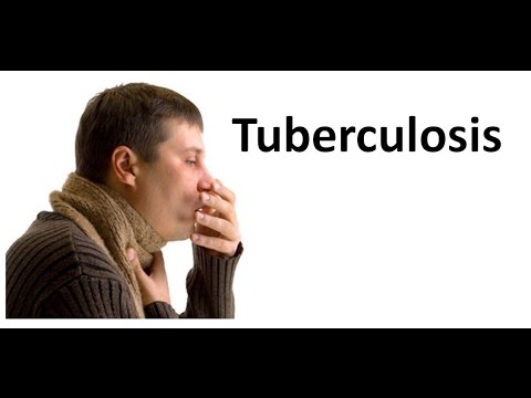 Tuberculosis