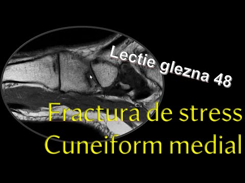 lectie glezna 48