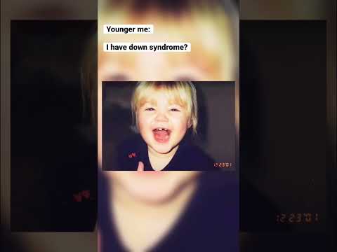 #mosaic #downsyndrome #genetics